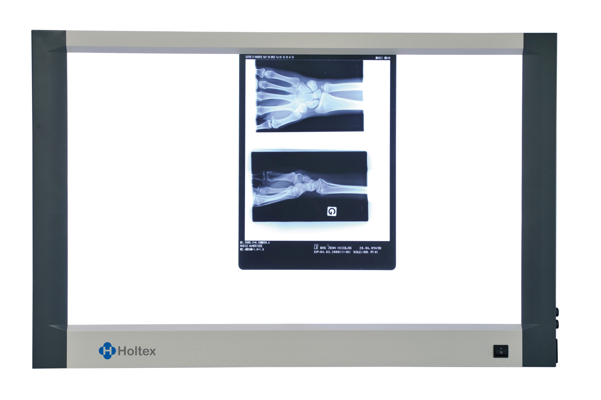Négatoscope Standard Holtex, 2 plages, 2 x 45W - SPENGLER MEDICAL